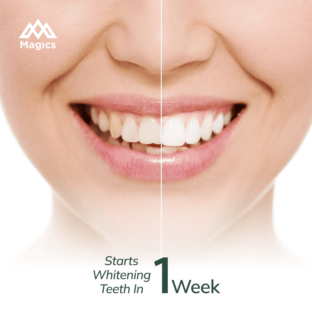 best teeth whitening toothpaste in india - Magics Care