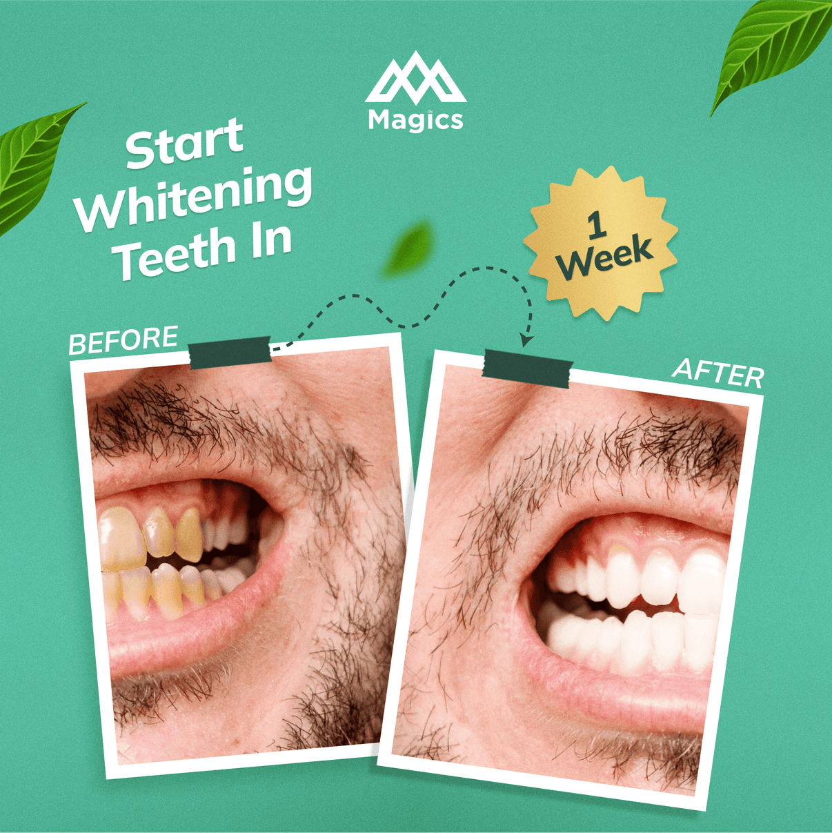 best teeth whitening toothpaste in india - Magics